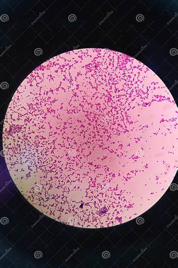Gram Staining Gram Positive Coccus Stock Image Image Of Design