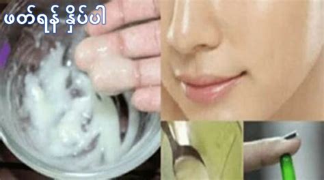 ဒါကို ၃ ညလိမ်းအိပ်ပါ သုံးရက်မြောက်နေ့မှာ မင်းသမီးလေးတစ်ပါးရဲ့ အသားအရေ ပိုင်ဆိုင်ပါလိမ့်မယ