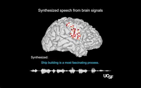 Scientists Get One Step Closer To Decoding Thoughts Into Speech Pbs News