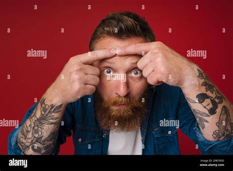 Adult Bearded Tattooed Handsome Stylish Redhead Man Crushing His Pimple