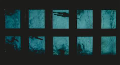 The Power Of Contrast Resolution In Ct Imaging