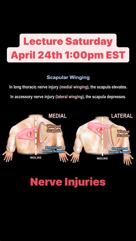 Nabil Ebraheim Md On Linkedin Dr Ebraheim Is Hosting A Lecture To