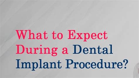Dental Implant Procedure Dental Implants Flower Mound Texas