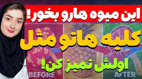 پاکسازی کلیه۷ میوه که کلیه های شما رو تمیز میکننپاکسازی کلیه ها با میوه های معجزه آسا Youtube