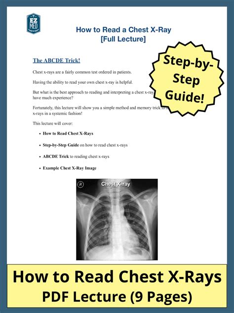 How To Read A Chest X Ray Pdf Abcde Mnemonic Step By Step Interpretation Approach — Ezmed