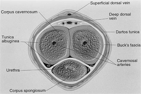 Penile Fracture Renal Medbullets Step 23