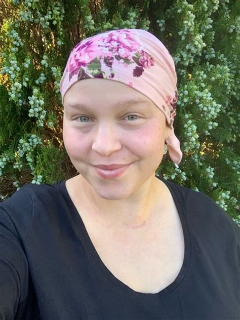 Minas Story Stage 2 Nodular Sclerosing Classical Hodgkin Lymphoma