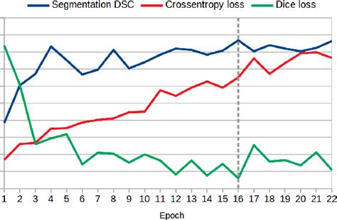 Figure 3 From Sunet A Deep Learning Architecture For Acute Stroke Lesion Segmentation And
