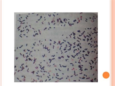 Clostidium Perfringens Ppt