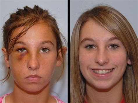Types Of Facial Reconstructive Plastic Surgery Telegraph