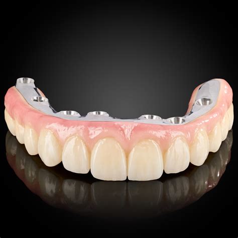 Full Arch Implant Xdent Lab