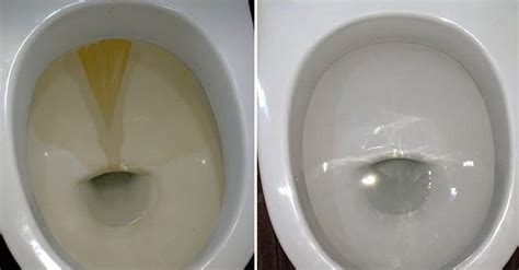 გულმოდგინე დიასახლისმა გაგვიზიარა საპირფარეშოს საწმენდი საშუალების რეცეპტი ახლა უნიტაზში