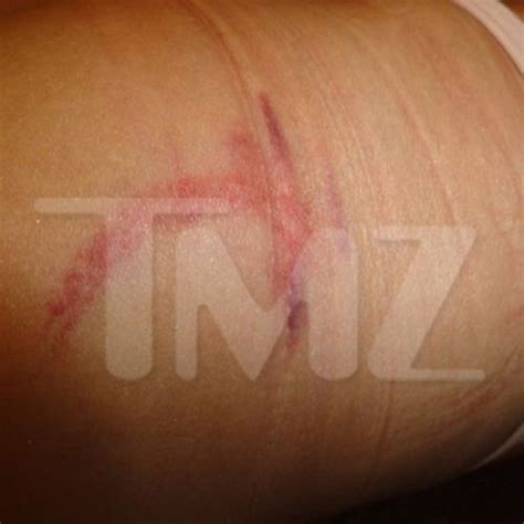Tila Tequila Attacked At Rowdy Concert 12 Pics