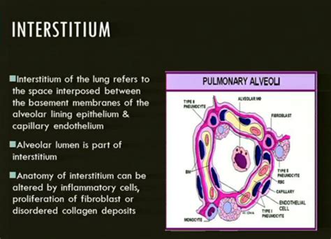 Interstitial Lung Diseases Flashcards Quizlet