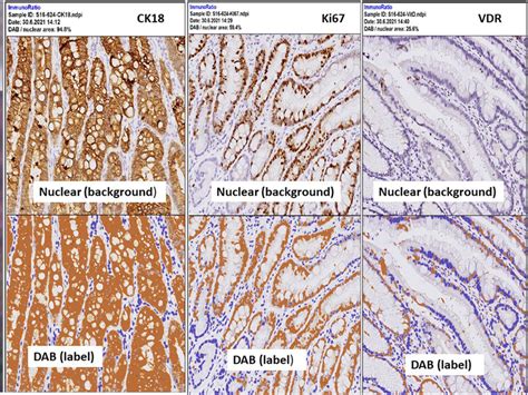 Ihc Expressions By Immunoratio Imagej Plugin Software Processed From