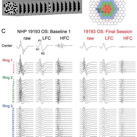 Representative Example Of A Pattern Electroretinogram Response Download Scientific Diagram