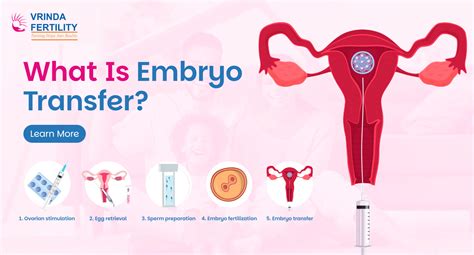 Ivf Embryo Transfer Explained Vrinda Fertility