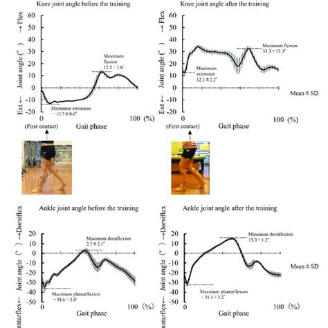 Knee And Ankle Joints Angle On The Affected Side During Gait Before And Download Scientific