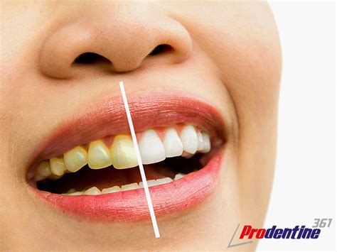 دلیل زرد شدن دندان چیست و چگونه رفع می‌شود؟