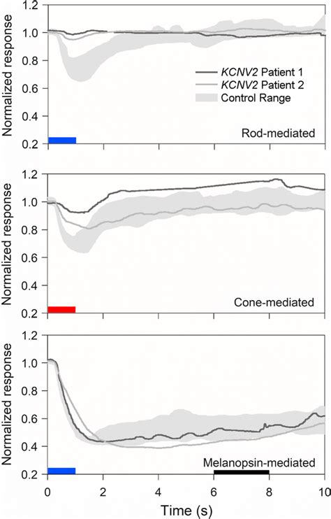 Pupillary Light Reflex To Rod Cone And Melanopsin Mediated Stimuli