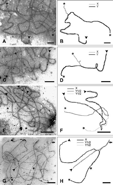 Electron Micrographs Of Pachytene Synaptonemal Complex Configurations