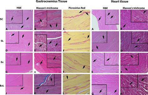 Presentation Of Stains Used For Histopathological Examination Of The Download Scientific