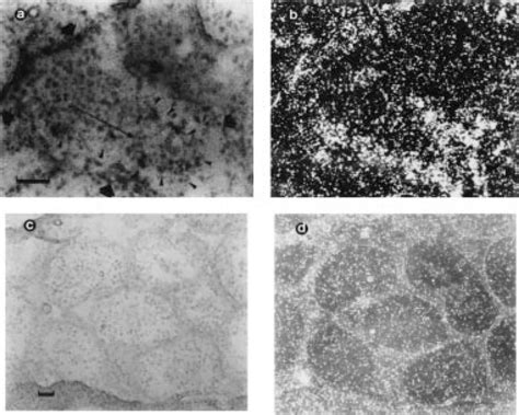 In Situ Hybridization Analysis Of Human Testis Sections From Biopsies