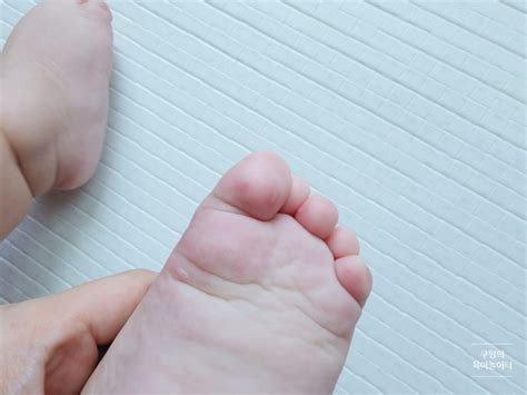 영유아 수족구병 유행 초기 약 치료 열 전염기간 네이버 블로그