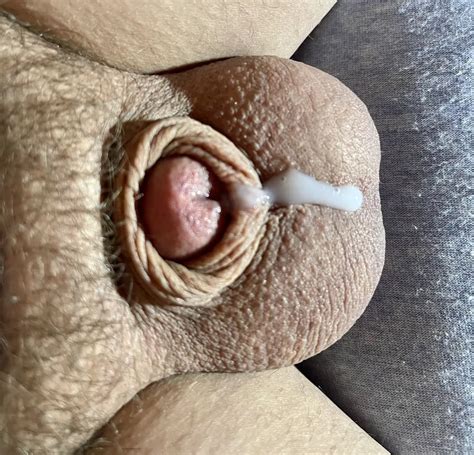 Tiny Penis Micro Cock Inverted Cock Photos 8 Nude Pics Xhamster