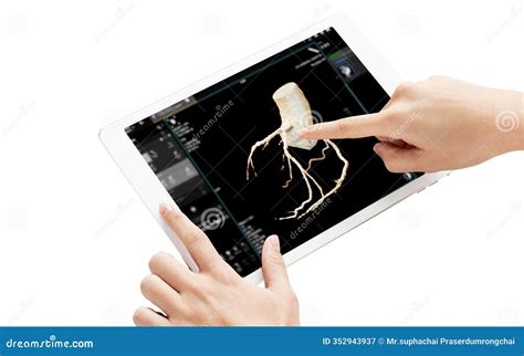 The Tablet Screen Highlights A Realistic Coronary Cta Image With A