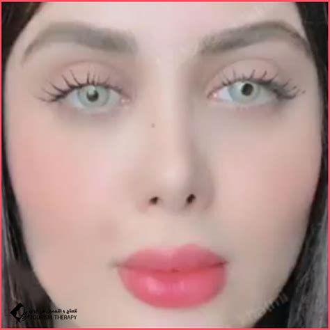 المواصفات والسعر وشراء تجميل الأنف الدكتور حسين ختمي