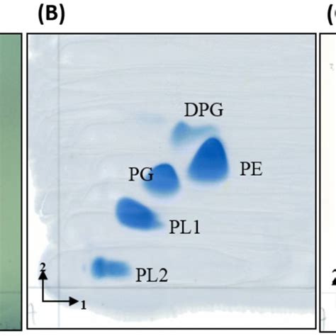 Polar Lipid Profile Of Strain 17j27 24t After Two Dimensional