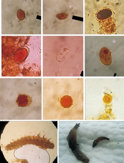Parasites In Vegetables A T Trichiura Whipworm Egg B G
