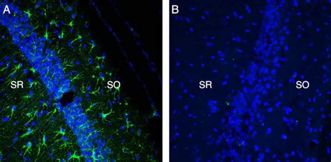 Trem2 Extracellular Polyclonal Antibody Anr 018 200ul