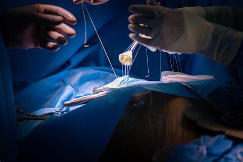 Protezare Valvulară Aortică Prin Minitoracotomie Recuperare Rapidă Spitalul Monza