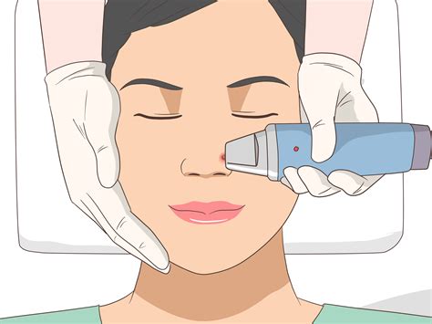 How To Shrink Pimples 13 Steps With Pictures WikiHow