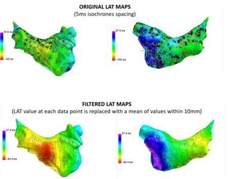 Calculating Wavefront Propagation Velocity Map Pawel Kuklik Phd