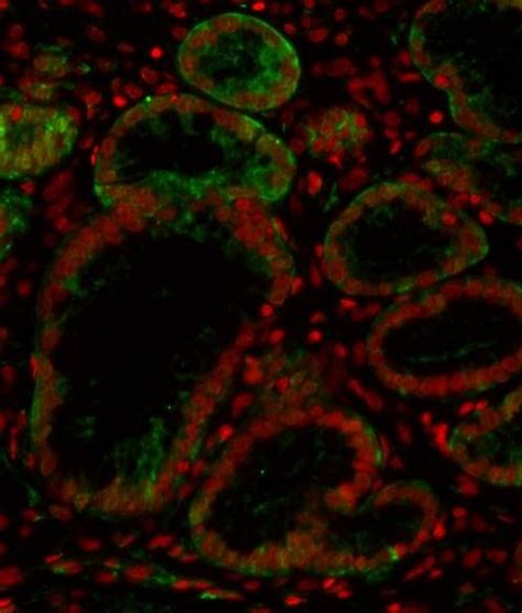Human Galectin 8 Antibody Af1305 Randd Systems