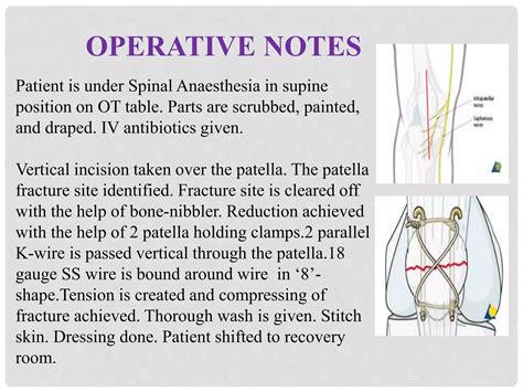 Fracture Of Patella Pptx