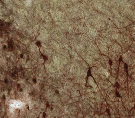Three Color Ihc Staining On Free Floating Sections From Human Brain Enzo
