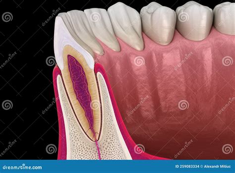 Anatomy Of Maxillary Lateral Incisor Tooth And Gum Cross Section