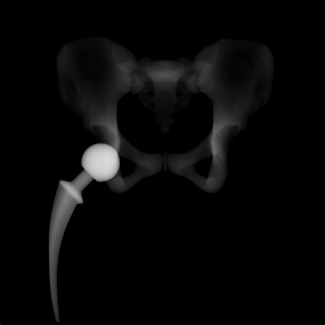 Github Jstnmchl Xraysimulator A Simple X Ray Simulator Written In Matlab