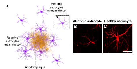 Figure 2 From Astrocyte Heterogeneity Impact To Brain Aging And