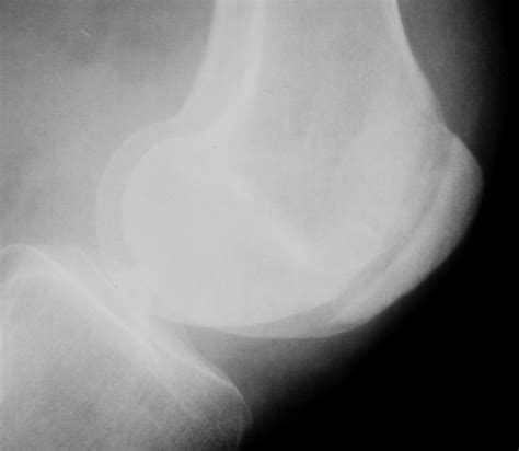 Ucsd Musculoskeletal Radiology
