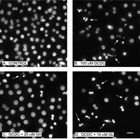 Fluorescence Microscopy Of Hepatocyte Nuclei Labeled With Dapi