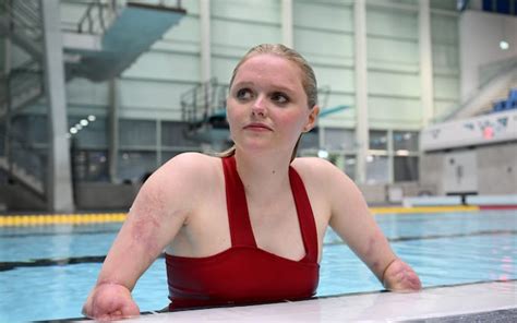 Hollywood Dolphin Inspired Ellie Challis To Become Paralympian Swimmer