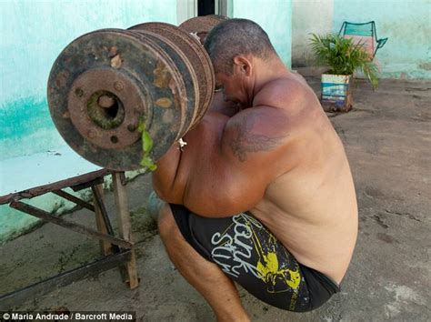 Bodybuilder Injects Himself With A Potentially Lethal Synthol To Grow