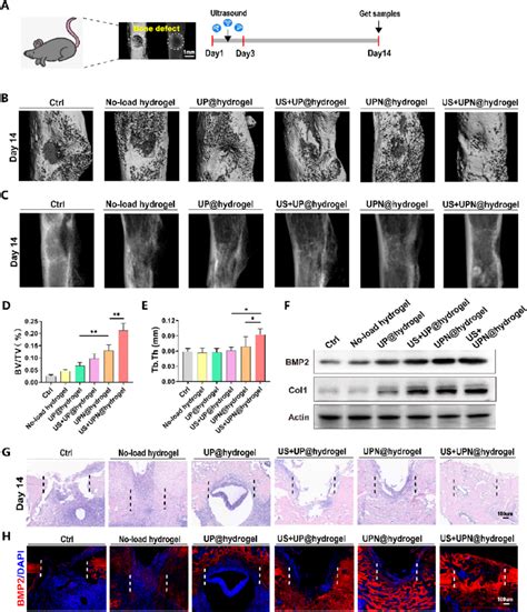 Ultrasound Responsive Upn Hydrogel Promotes Bone Defect Regeneration In Download Scientific