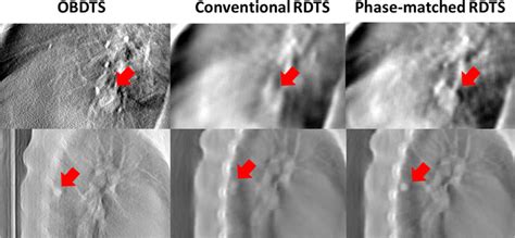 Visual Comparison Between The Obdts Images The Rdts Images Synthesized