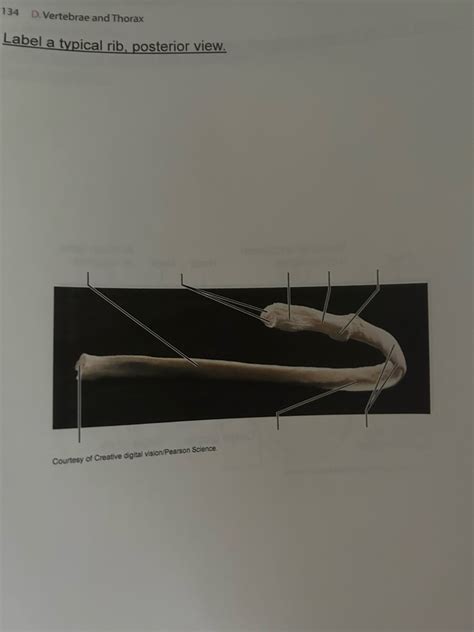 Typical Rib Posterior View Diagram Quizlet